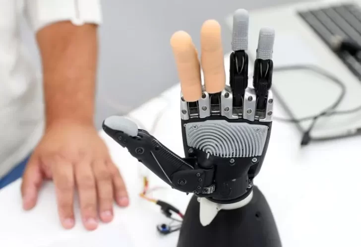 Un día como hoy: se implanta la primera mano biónica con sentido del ...