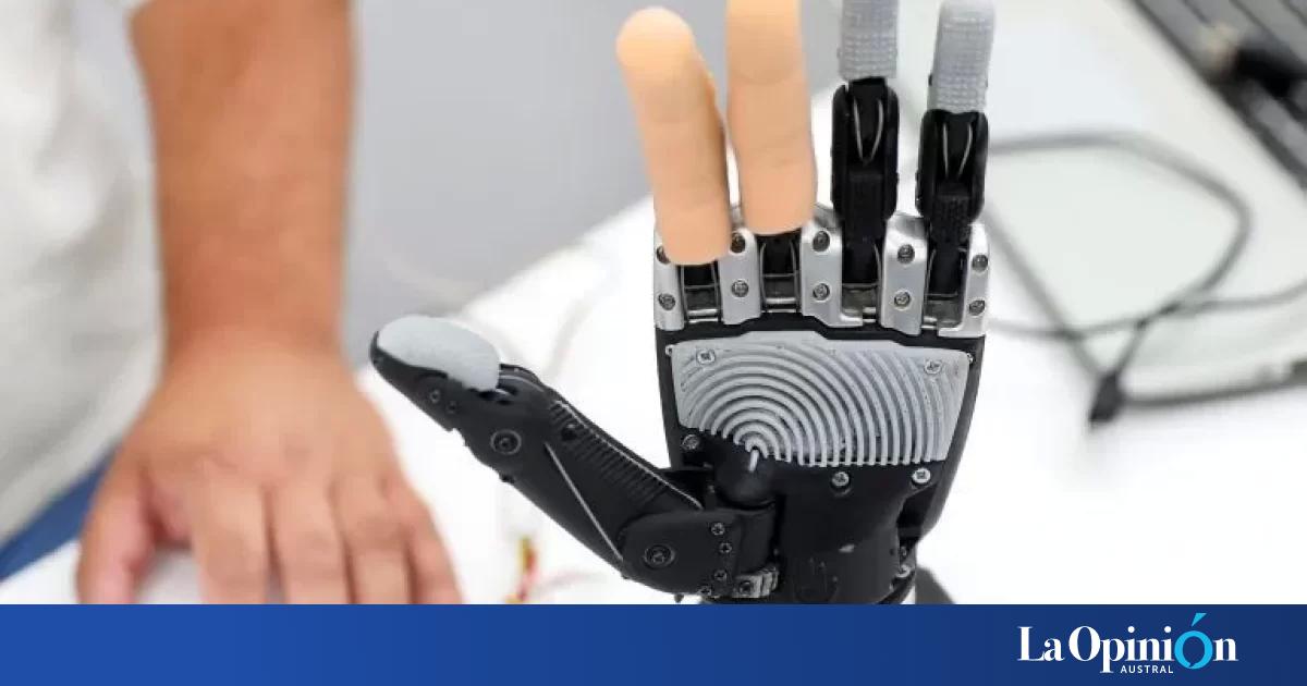 Un día como hoy: se implanta la primera mano biónica con sentido del ...