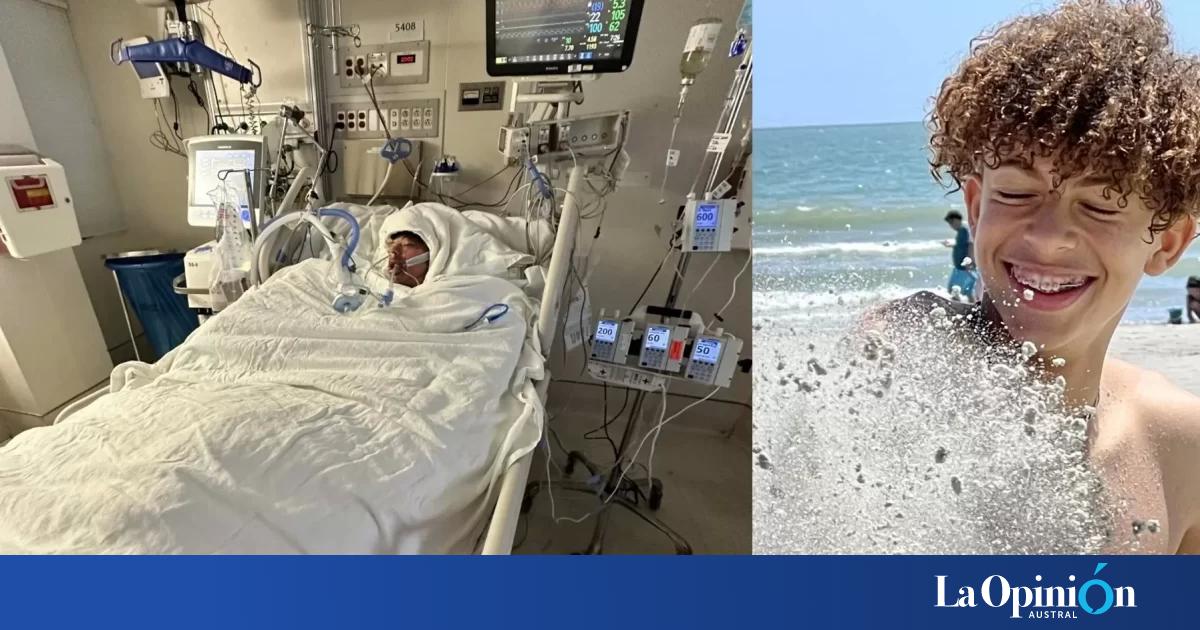 Adolescente de 16 años terminó con el 80% del cuerpo quemado por un ...