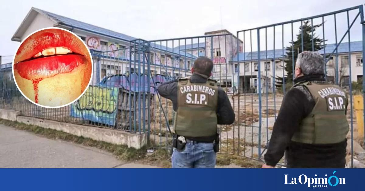 Un hombre le mutiló la lengua a su pareja de un mordisco y la policía ...