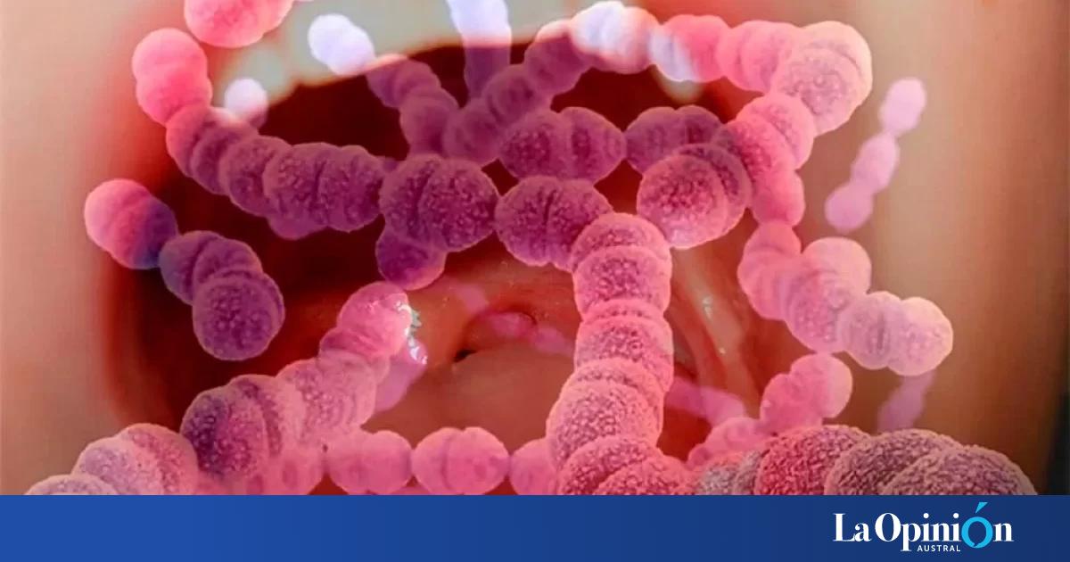 Faringitis aguda: tres muertes en Tierra del Fuego por infecciones con ...