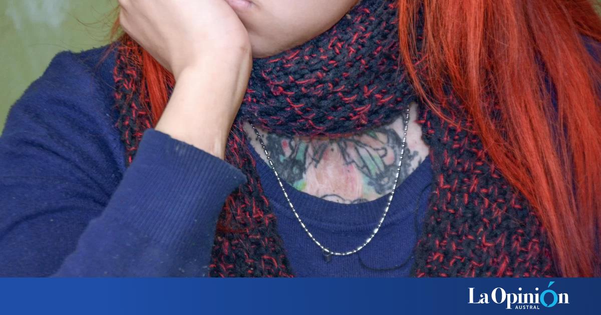 Detuvieron al agresor que quemó y torturó a María: “Voy a vivir feliz ...