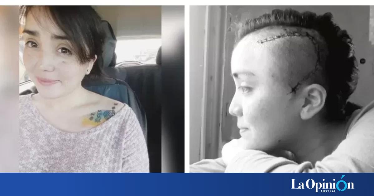 Tiene 29 años y debe ser operada por un tumor cerebral | La Opinión Austral