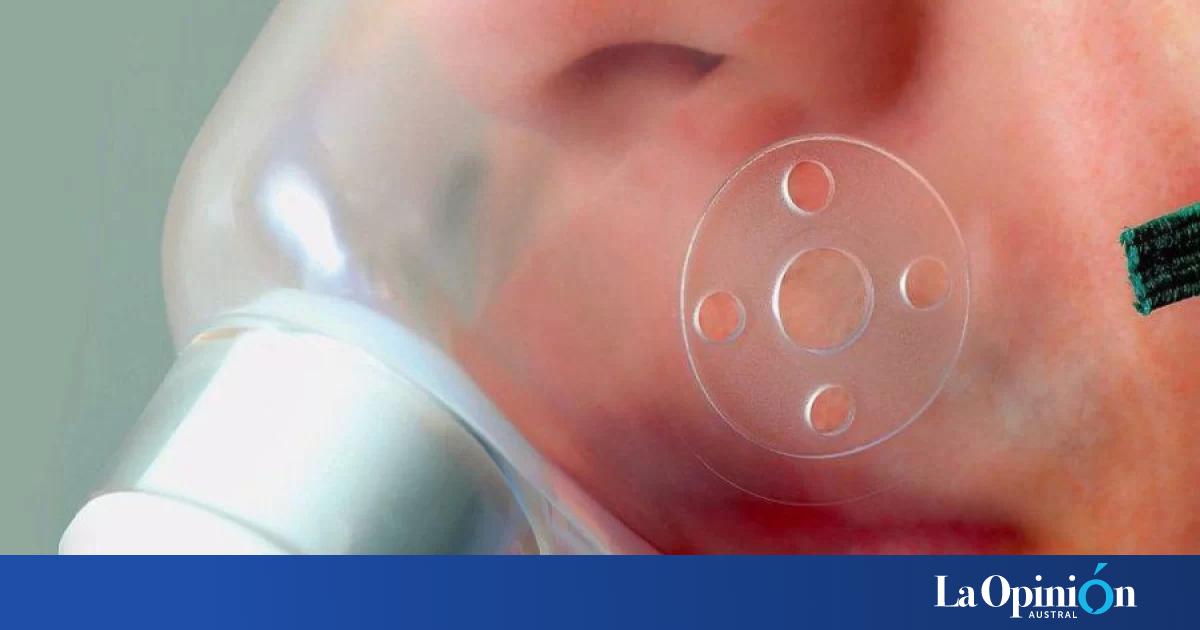 Martín Chávez sobre el ibuprofeno inhalado: “Estamos dispuestos a ...