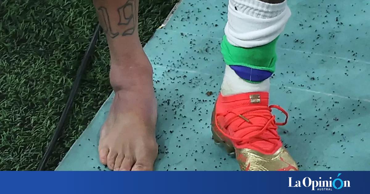 Qué es la entorsis de tobillo, la lesión que sufrió Neymar en el debut de Brasil en Qatar 2022 ...