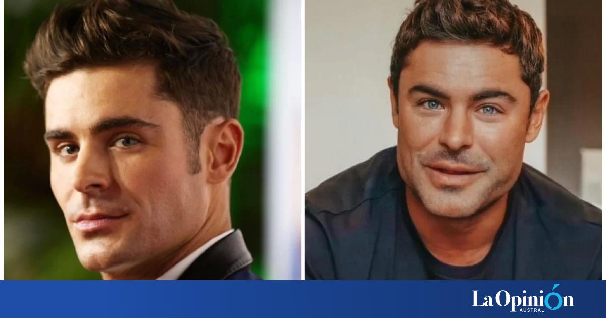 ¿qué Le Pasó A Zac Efron Una Foto Suya Se Hizo Viral Y Lo Comparan